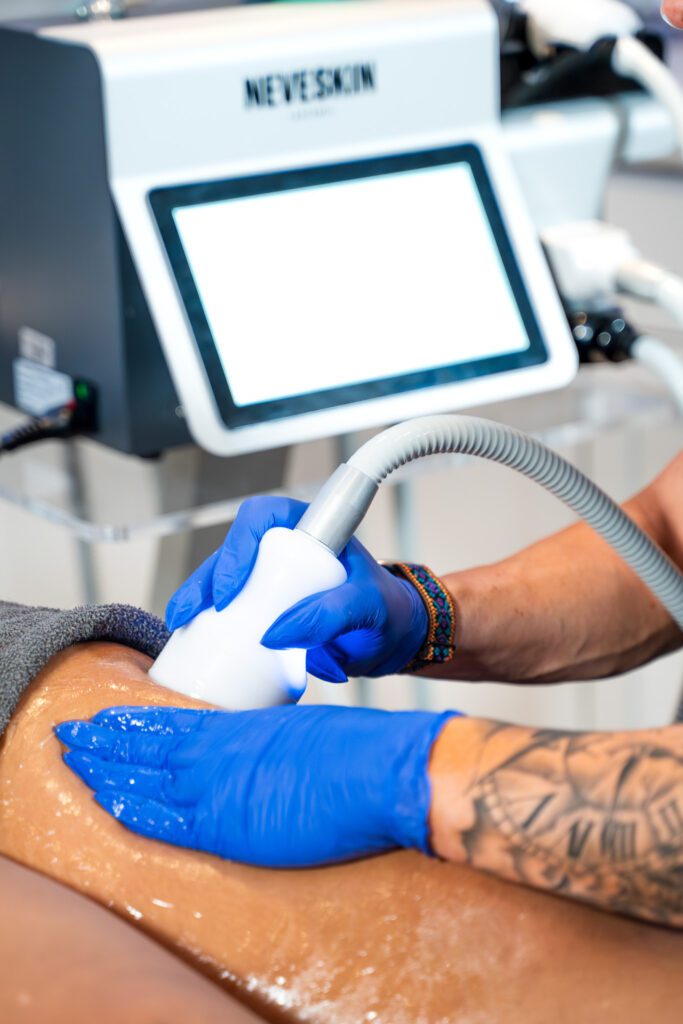 Body Sculpting | iCRYO | Near Me